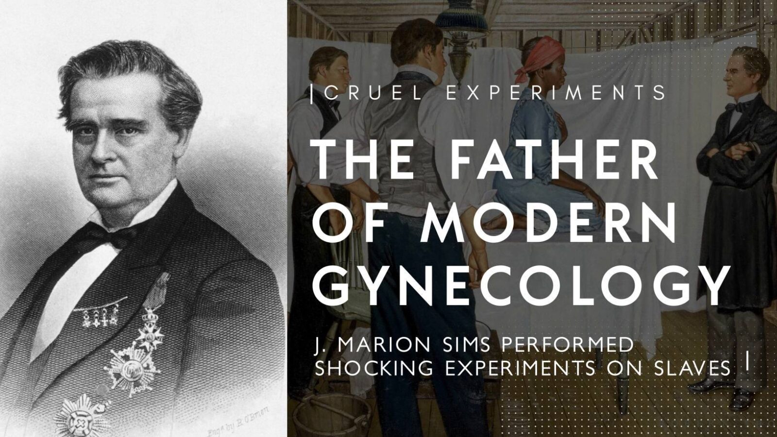 J. Marion Sims: The 'Father Of Modern Gynecology' Performed Shocking ...