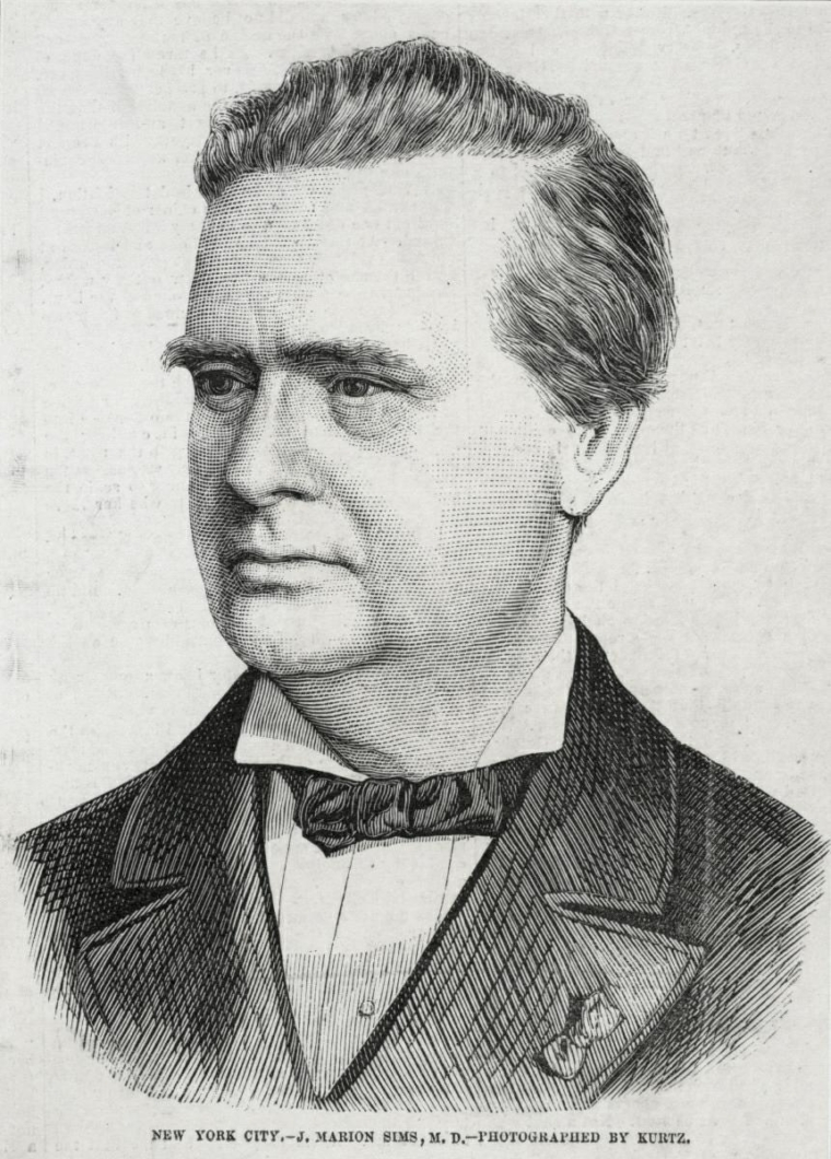 J. Marion Sims: The 'Father Of Modern Gynecology' Performed Shocking ...