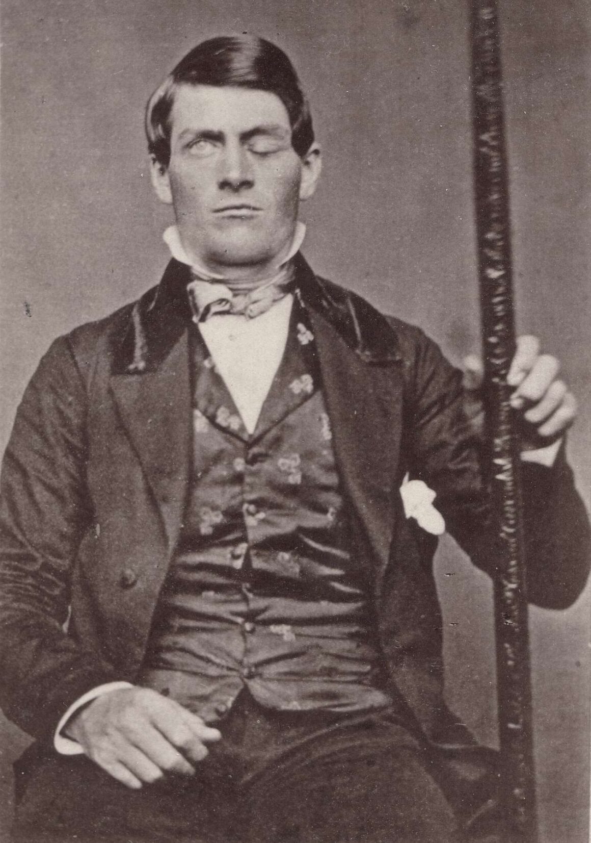 Phineas Gage — The Man Who Lived After His Brain Was Impaled With An ...