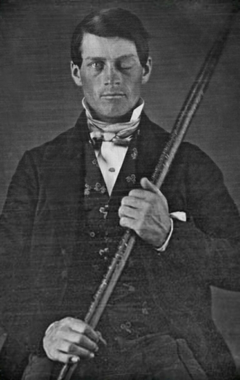 Phineas Gage — The Man Who Lived After His Brain Was Impaled With An ...